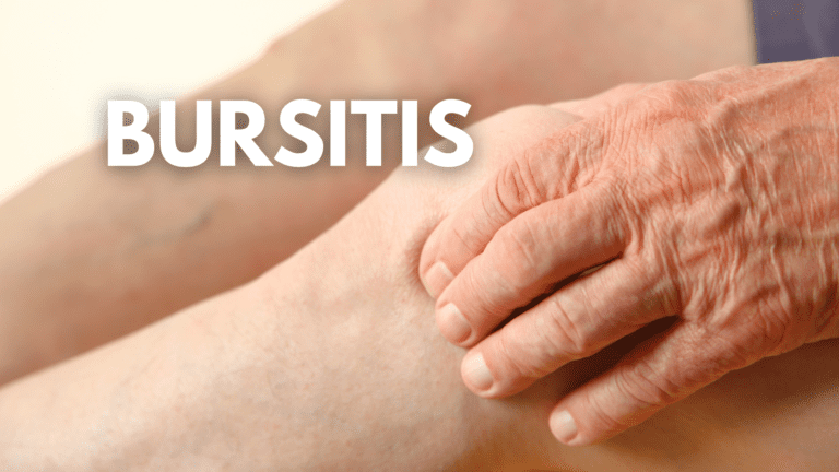 Bursitis De Rodilla ¿cómo Se Cura Y Cuánto Tiempo Tarda